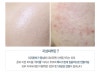 지성피부 스킨로션 개기름and트러블녀리뷰 네이버 블로그