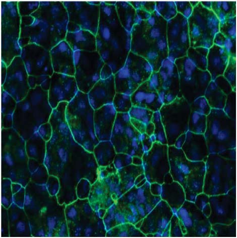 In Vitro Human Alveolar Tissue Model > BRIC